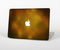 The Golden Metal Mesh Skin Set for the Apple MacBook Pro 15" with Reti ...